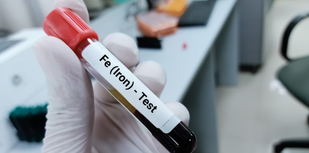 Obese and overweight children at risk of iron deficiency | School of ...